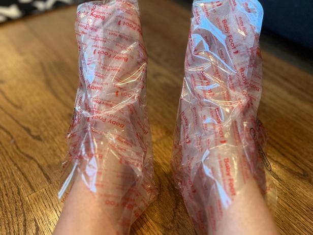 Baby Foot Peel Review 2024 | TLC.com