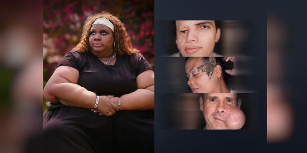 New TLC Medical Series: Dangerously Obese & About Face Premiere Dates ...